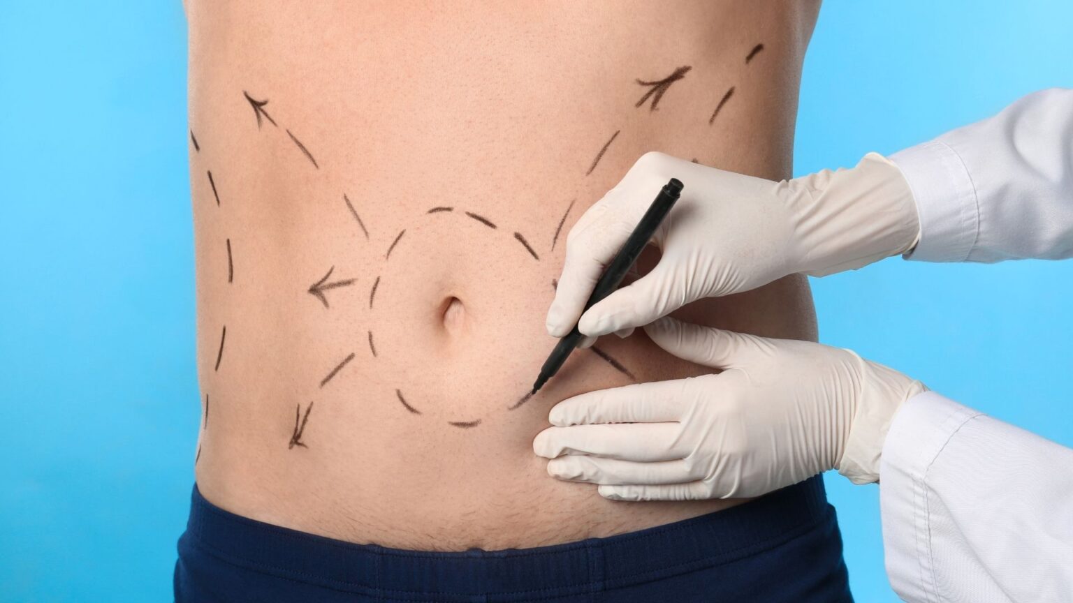 Types of abdominal surgeries - Sava Clinic